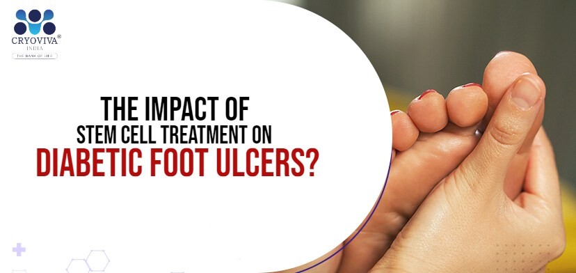 The Impact of Stem Cell Treatment on Diabetic Foot Ulcers? - cryoviva Blog