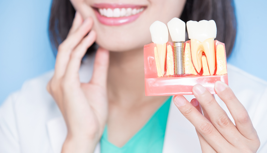 Dental Implants Explained: Function, Benefits & What to Expect ...