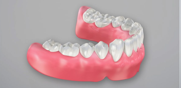 Dentures and Partial Dentures | Evergreen Dental Care